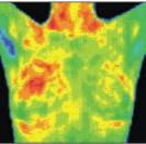Thermogram